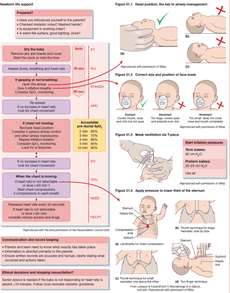 Neonatal Resuscitation – CHEMS Field Treatment Guidelines