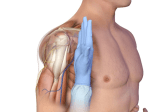 EZ-IO® Proximal Humerus Identification & Insertion Technique – Adult ...
