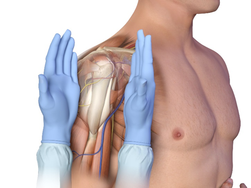 EZ-IO® Proximal Humerus Identification & Insertion Technique – Adult ...