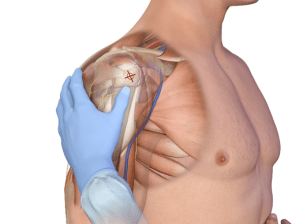 EZ-IO® Proximal Humerus Identification & Insertion Technique – Adult ...